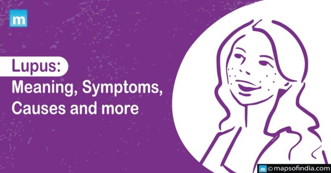 Lupus: Meaning, Symptoms, Causes and more - healt