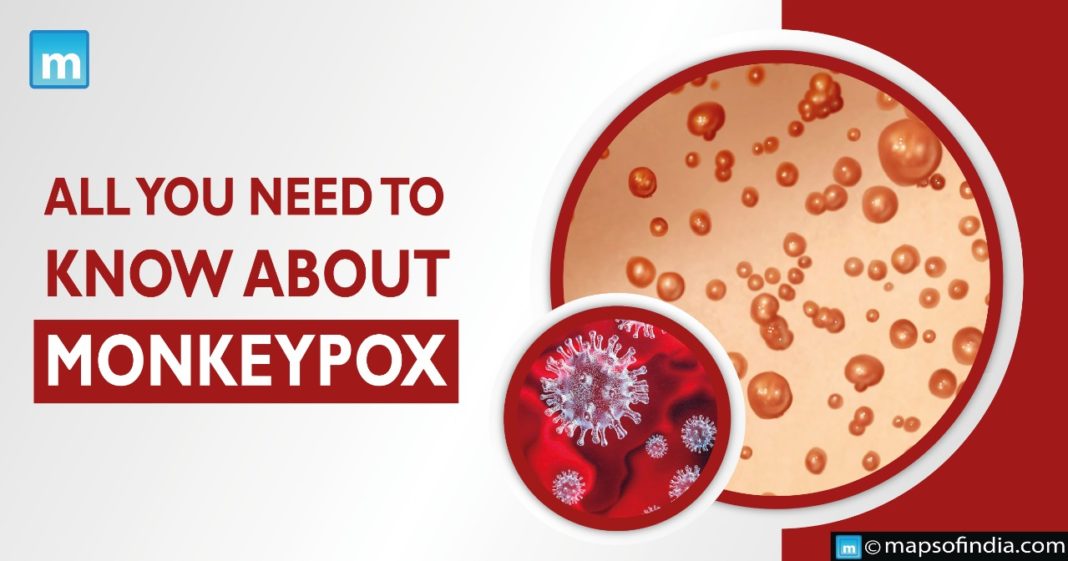Monkeypox: Meaning, Symptoms, Precautions and Treatment - Facts