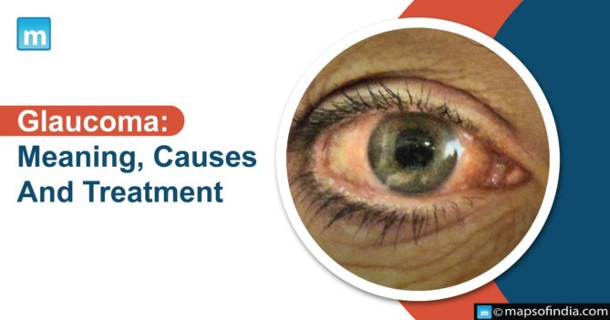 Glaucoma: Meaning, Causes And Treatment - Eyes