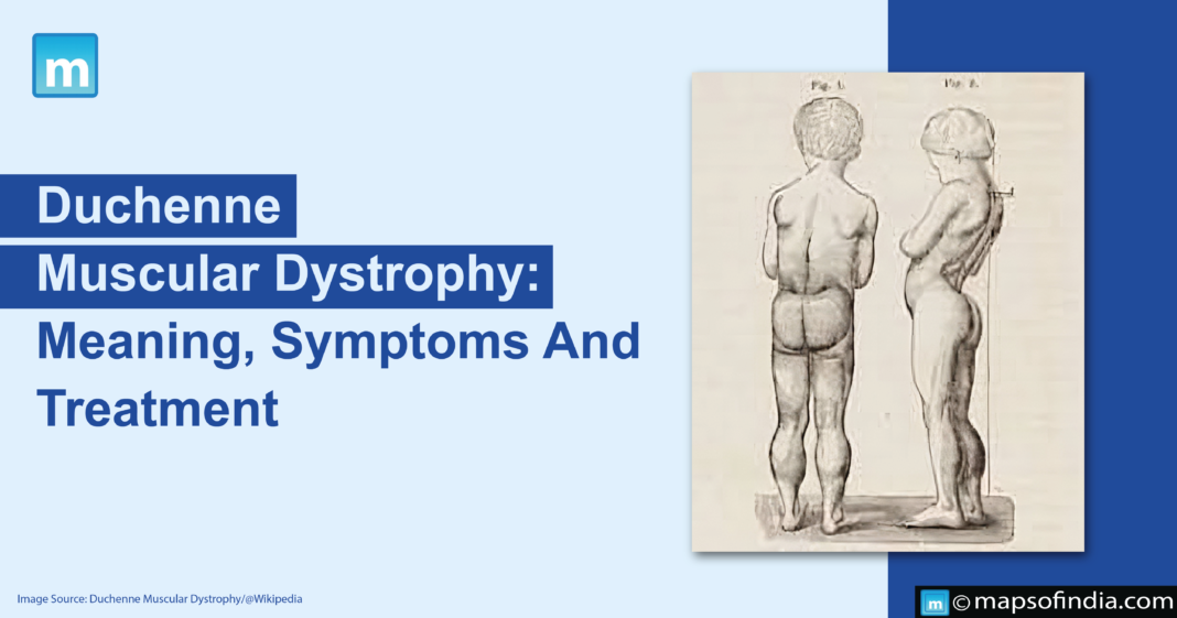 Duchenne Muscular Dystrophy: Meaning, Symptoms And Treatment - Fitness