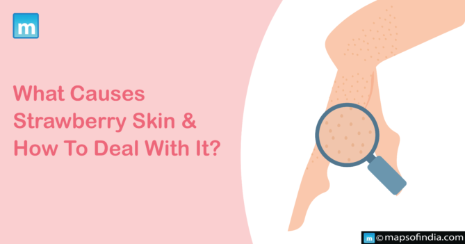 What Causes Strawberry Skin And How To Deal With It? - Health