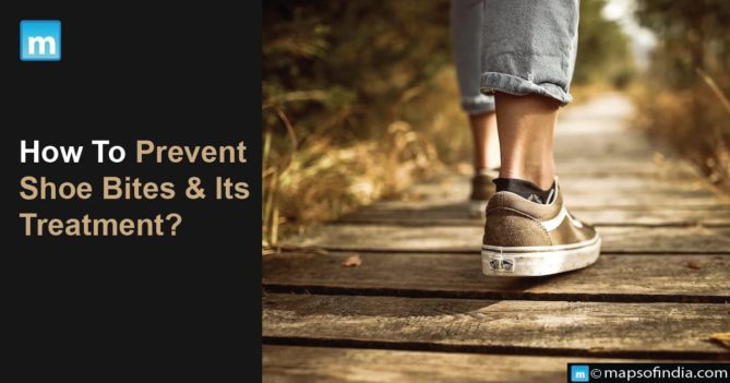 How To Prevent Shoe Bites And Its Treatment? - Health