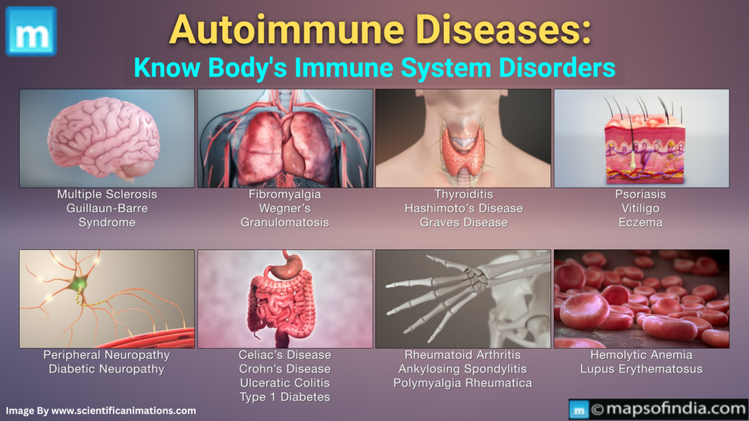 Autoimmune Diseases: Know Body’s Immune System Disorders - Bacteria