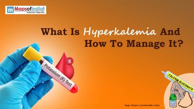 A Simple Guide To Managing Hyperkalemia